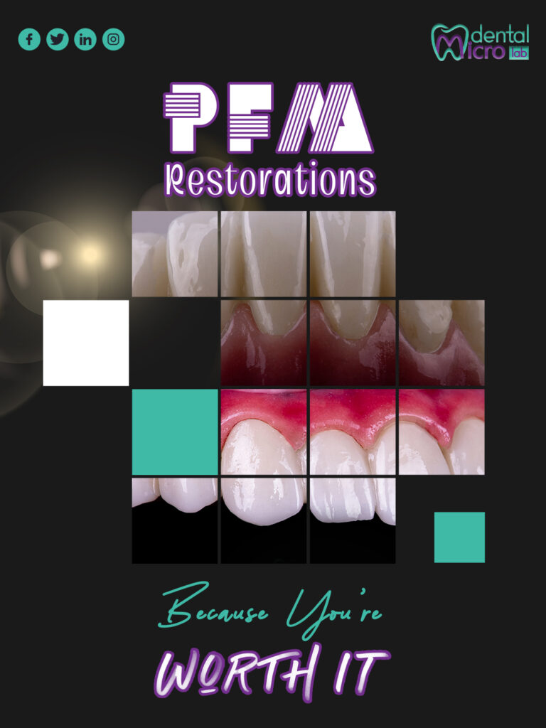 PFM Restorations - Microdental