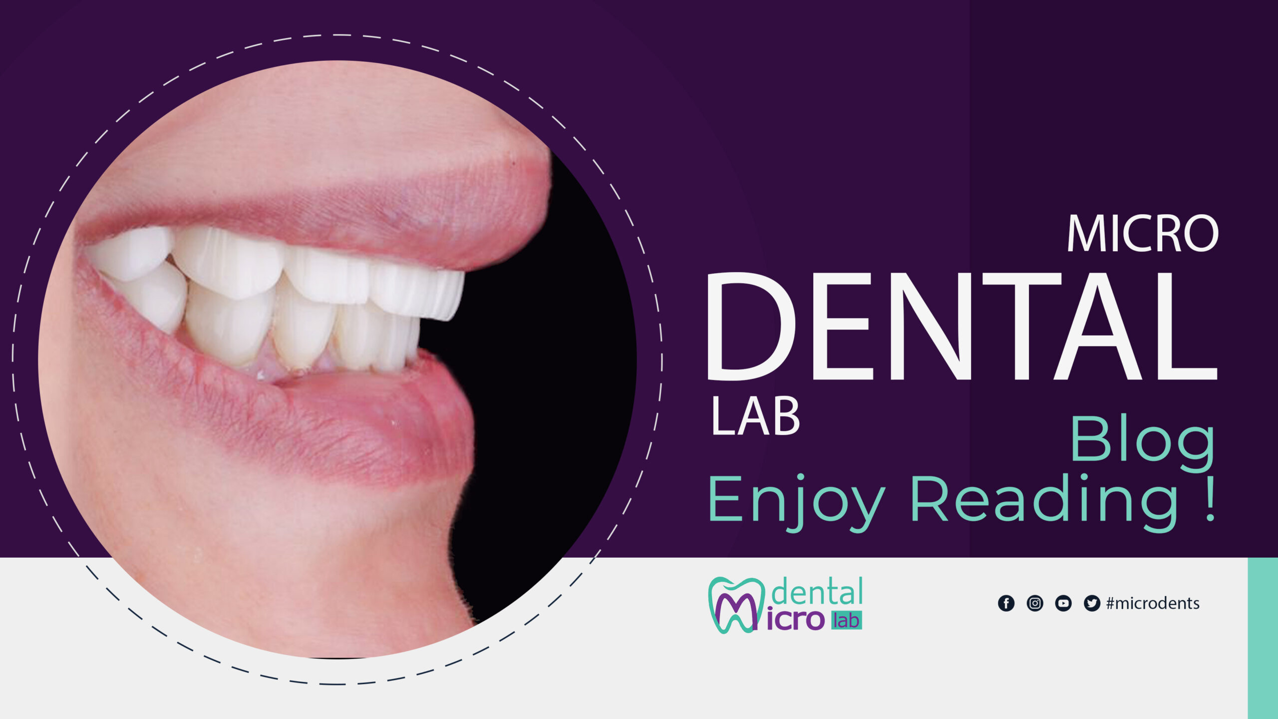 Blog - Microdental